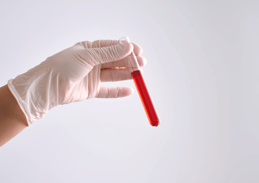 Hypocalcaemia • Happy Medics